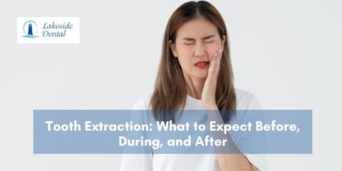 Tooth Extraction: What to Expect Before, During, and After - Lakeside ...